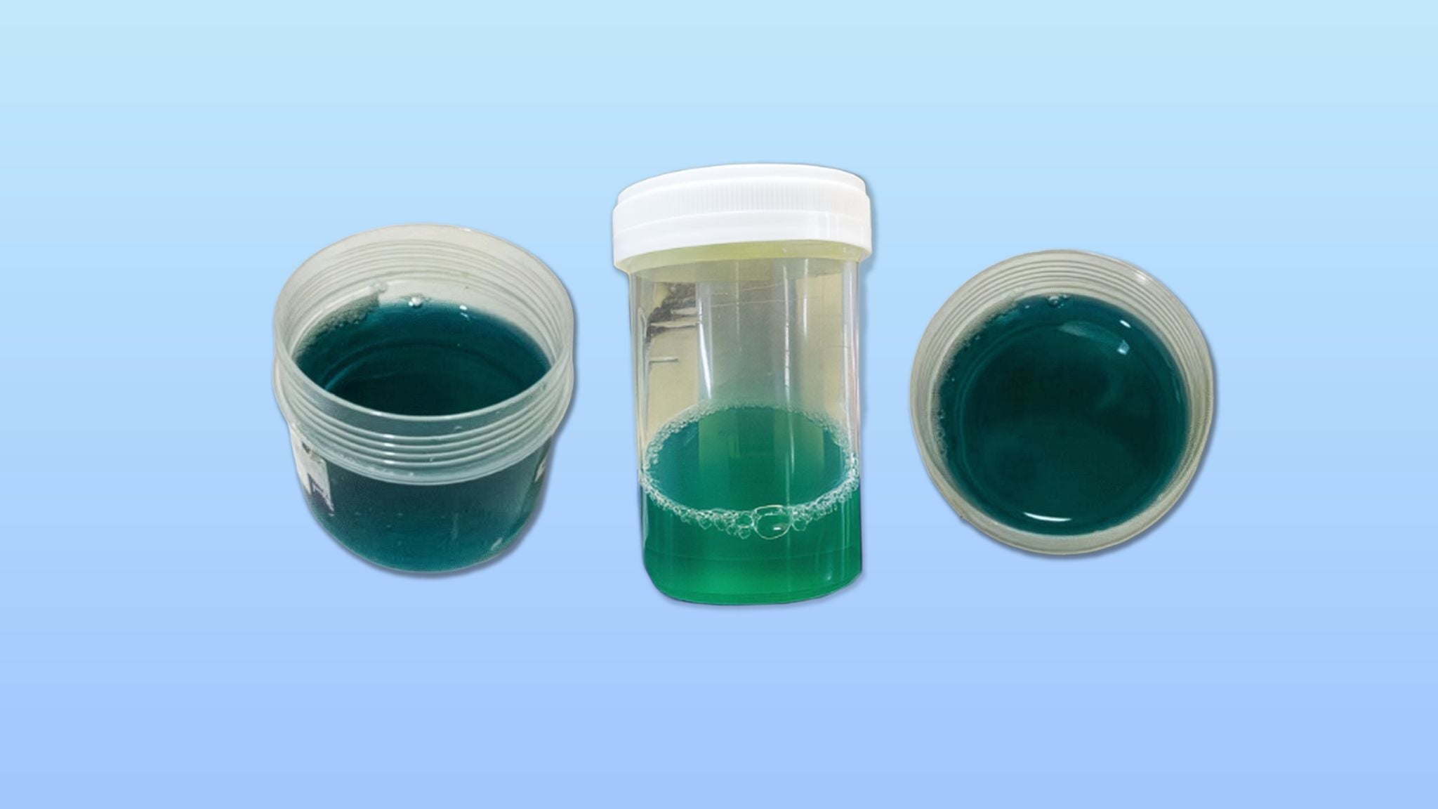 Why Methylene Blue Turns Your Pee Blue (But Not Always) – Nutricel ...